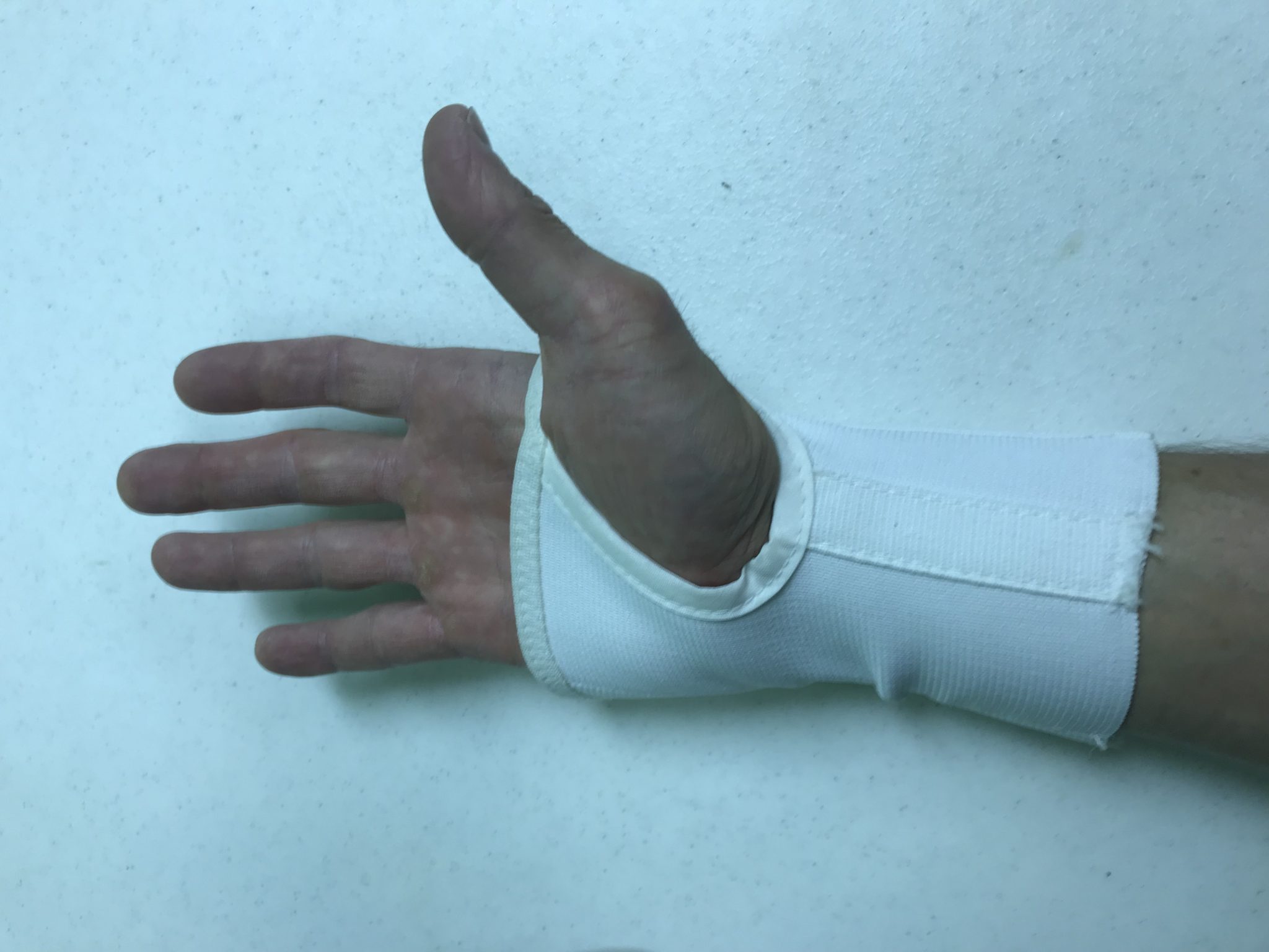 SPORTS Wrist Splint DePuy #3802 Elastic Hook & Loop (SM/MD/LG) - BMF ...